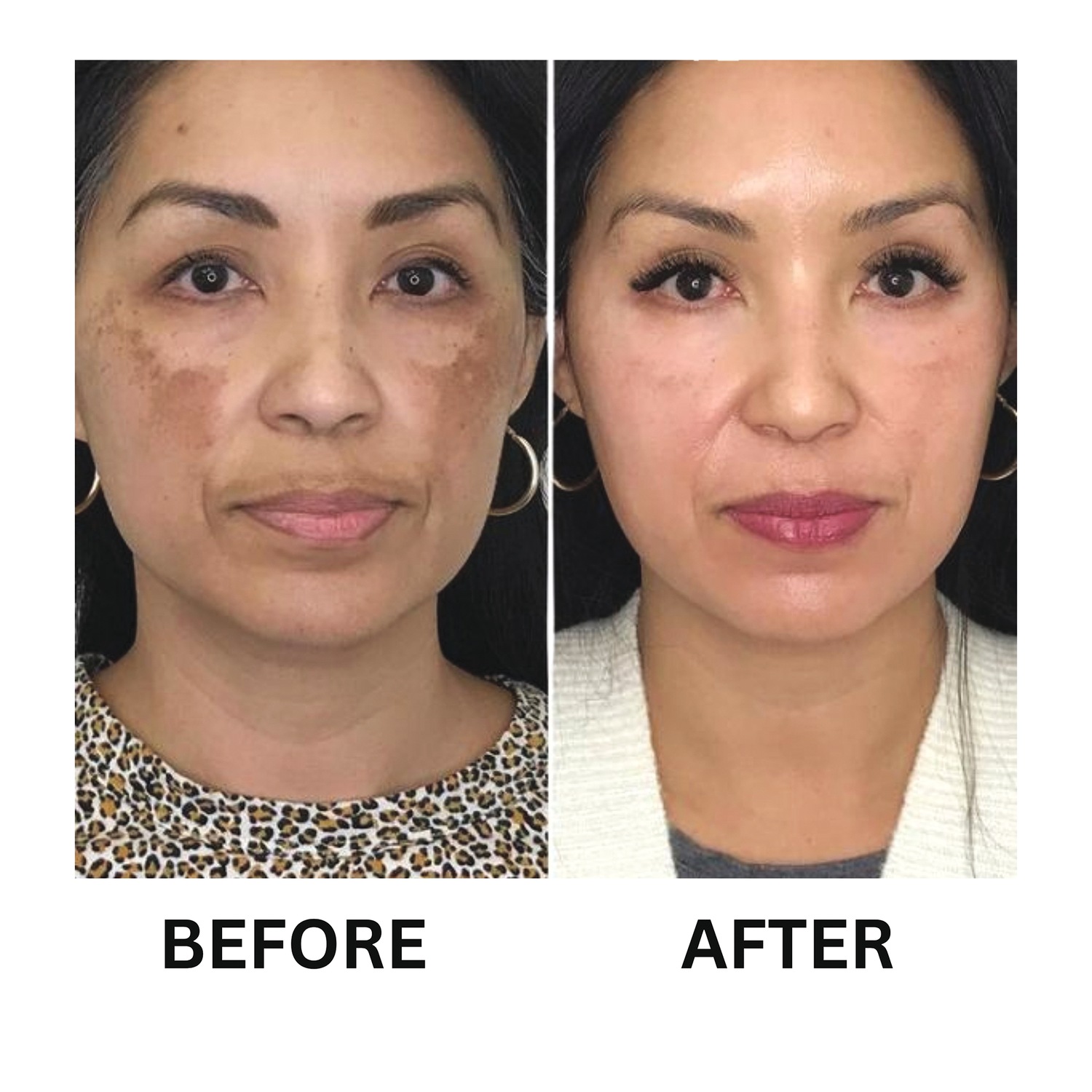 Skin Whitener Bleaching Cream | Carol Wright