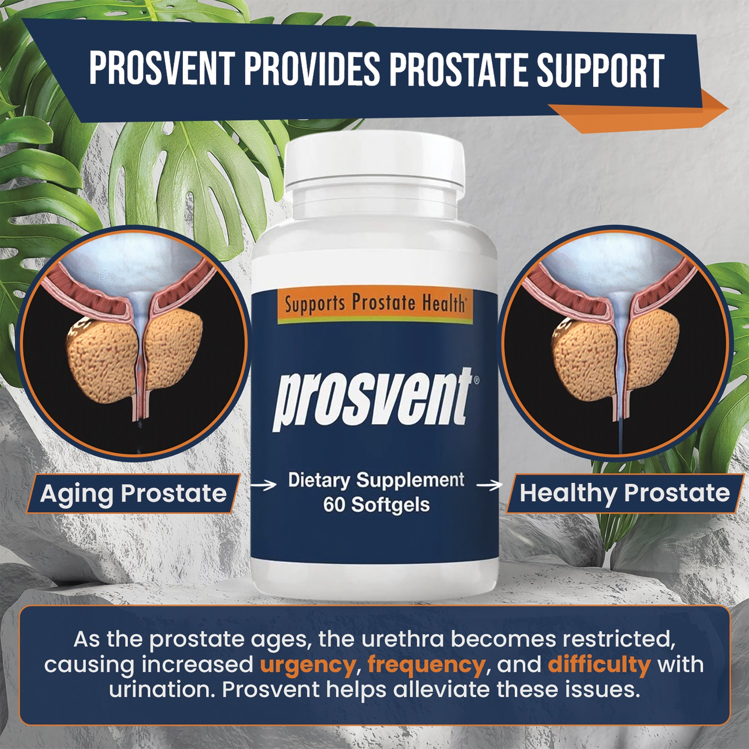 Prosvent Prostate Supplement | Carol Wright