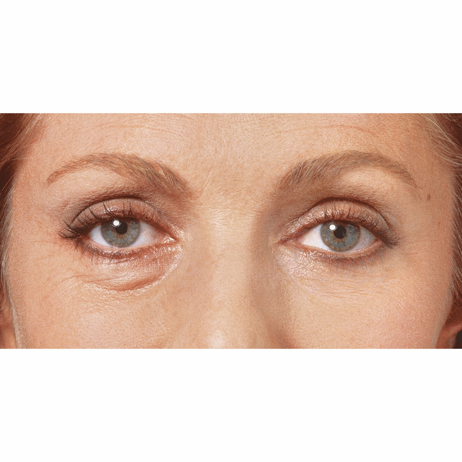 Sudden Change Under-Eye Serum | Carol Wright
