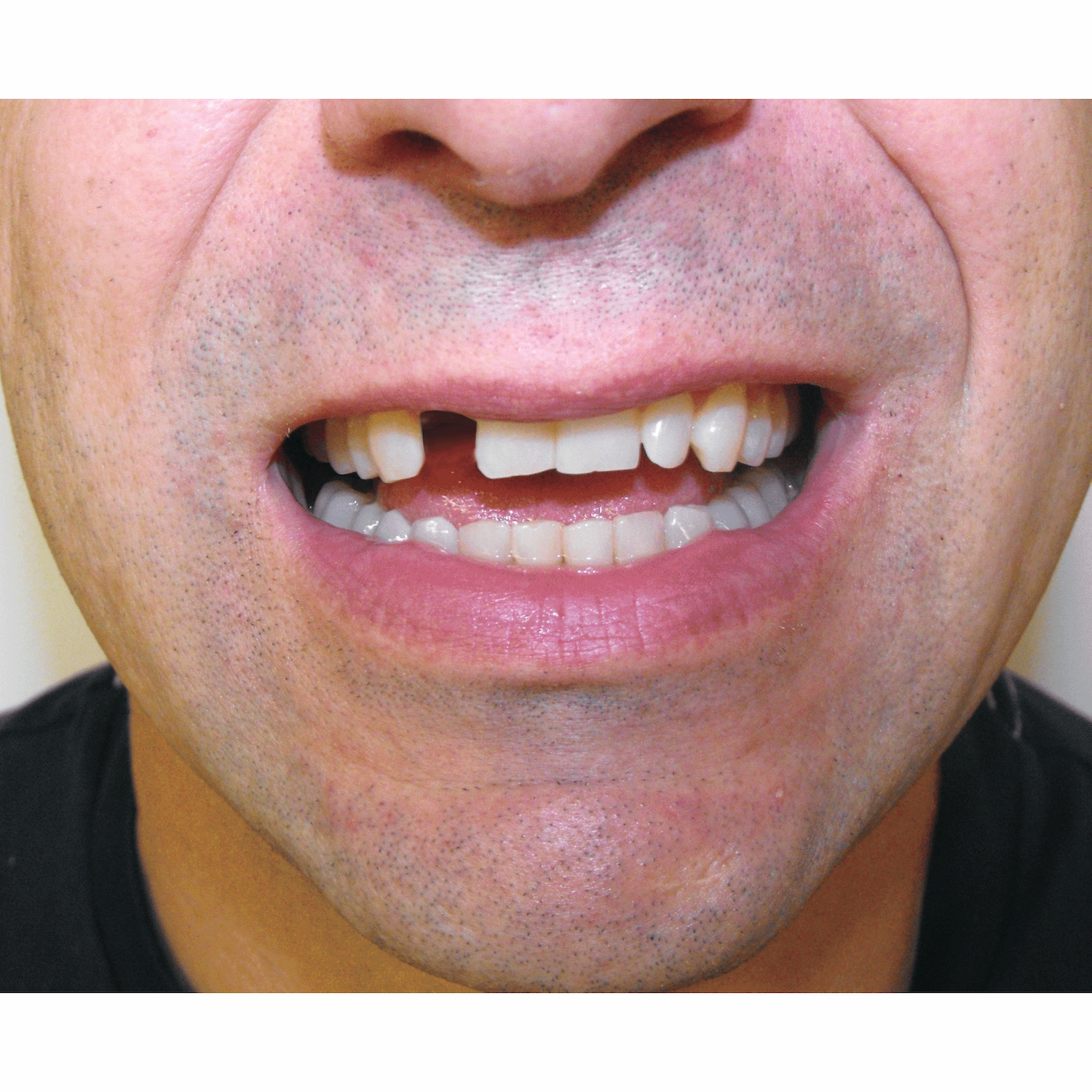 Instant Smile | Carol Wright